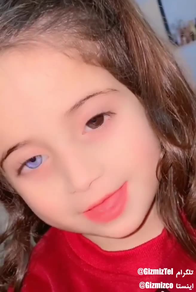دختر بچه ای با چشمان دو رنگ